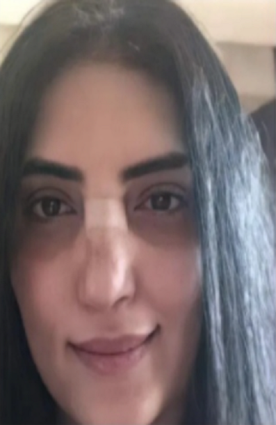 أنف حورية فرغلي يثير الجدل على السوشيال ميديا والفنانة ترد «صورة